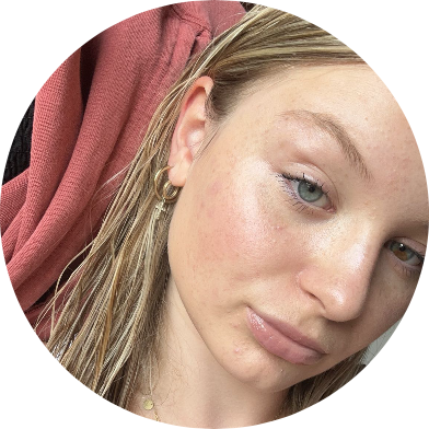 Lisa Menzel | Wonderlink